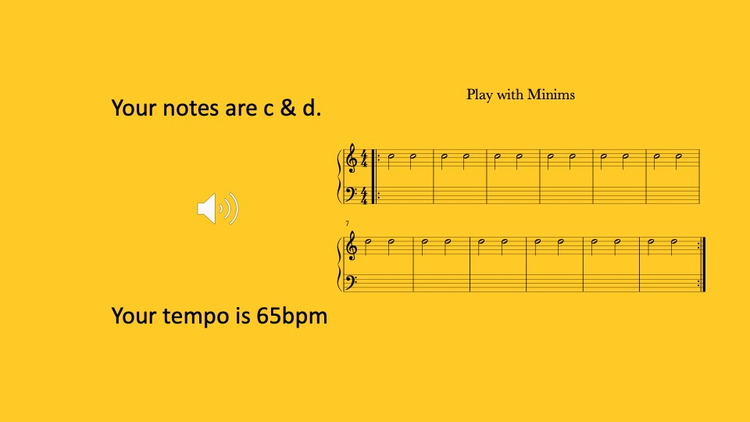 "Mastering Note Value Rhythms: A Guide to Learning and Playing Music ...